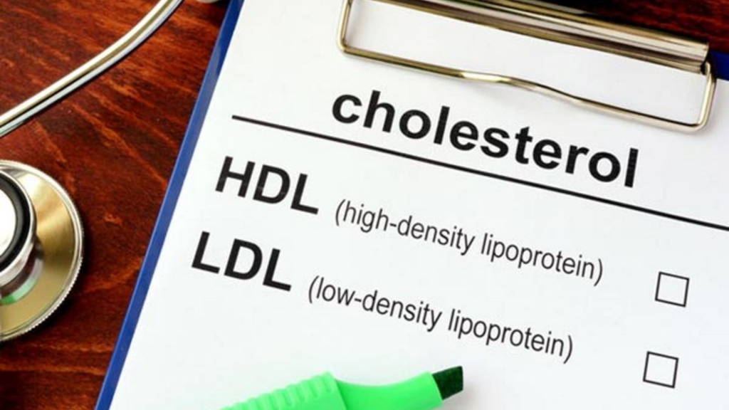 Cholesterol: Symptoms, Treatment, and The Role of Obesity in ...